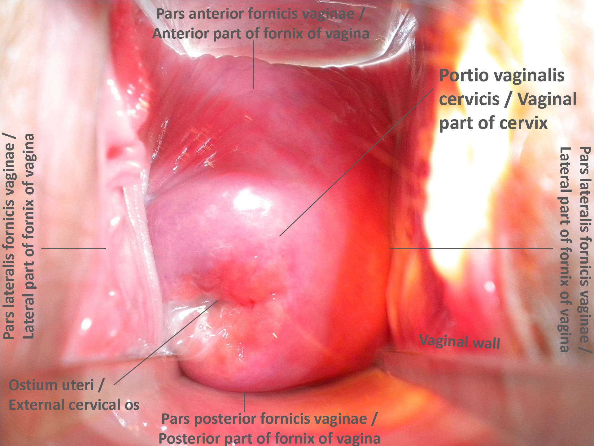 Photo Intravaginal view of normal cervix uteri - Latin and English labels | AnatomyTOOL